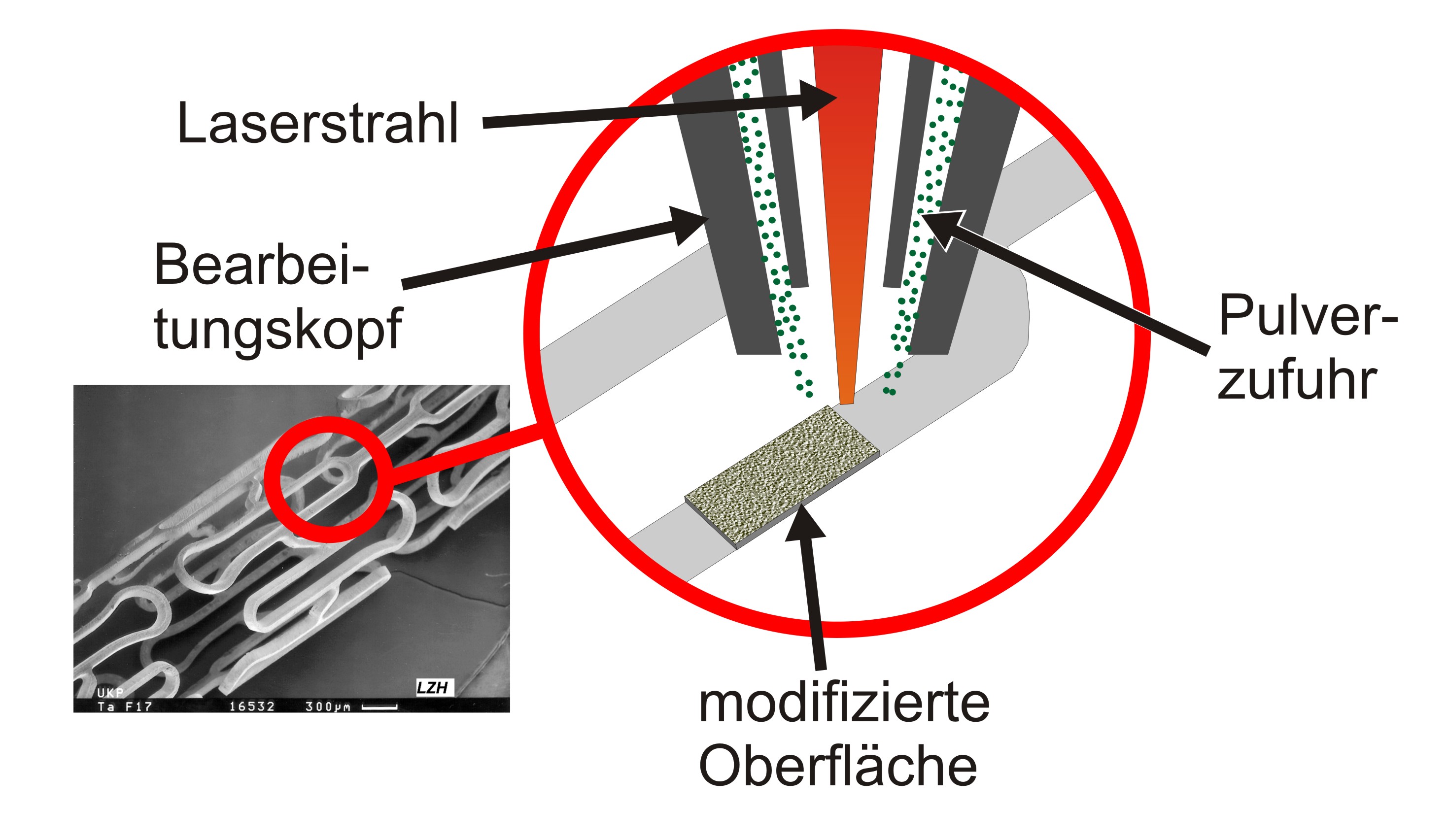 Verbesserte Mikroimplantate durch Lasersintern | Laser Zentrum Hannover ...
