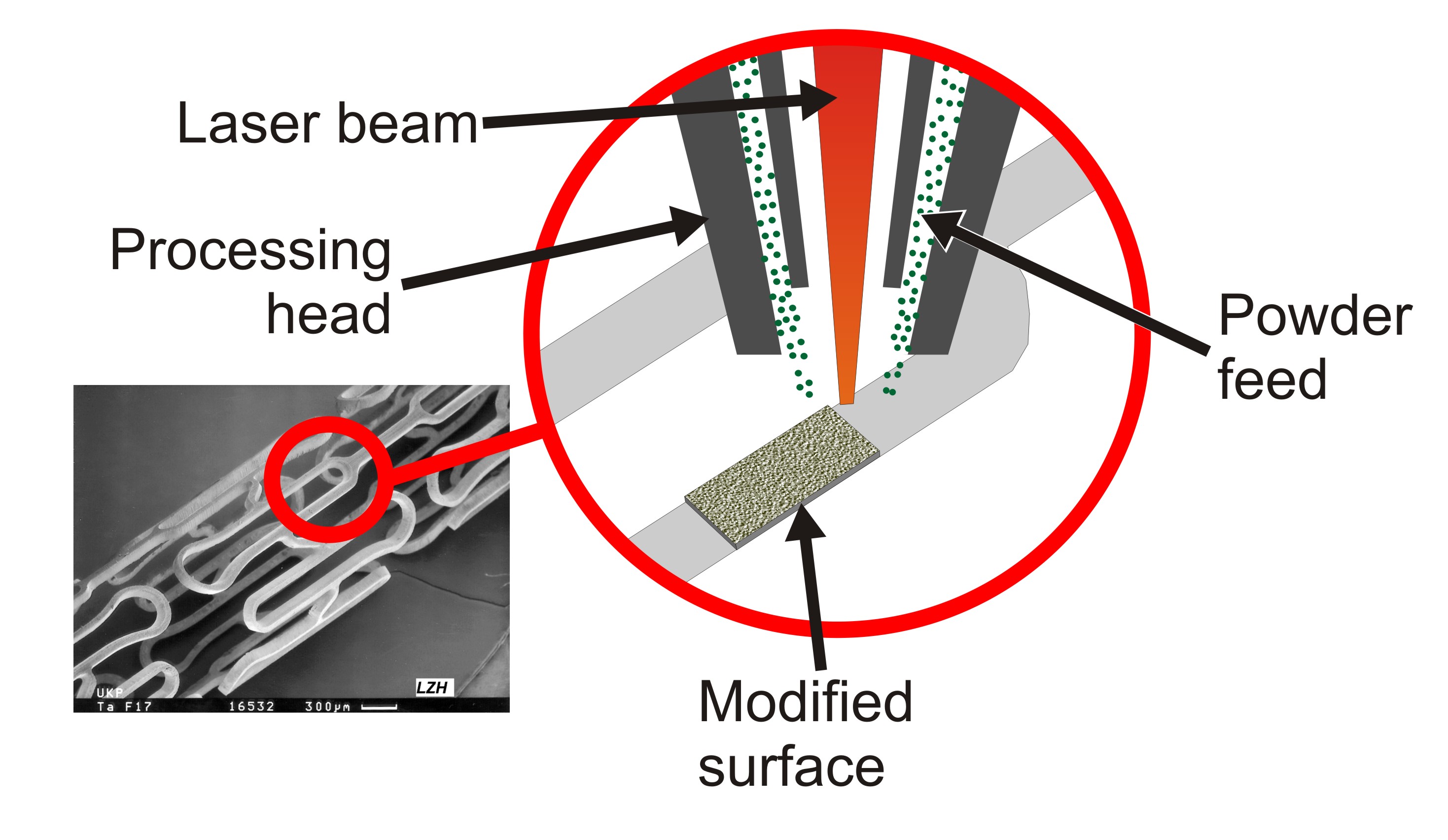 Improved Micro-Implants through Laser Sintering | Laser Zentrum ...